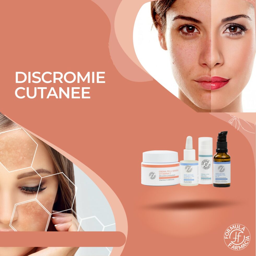 DISCROMIE CUTANEE - Formula Farmacia